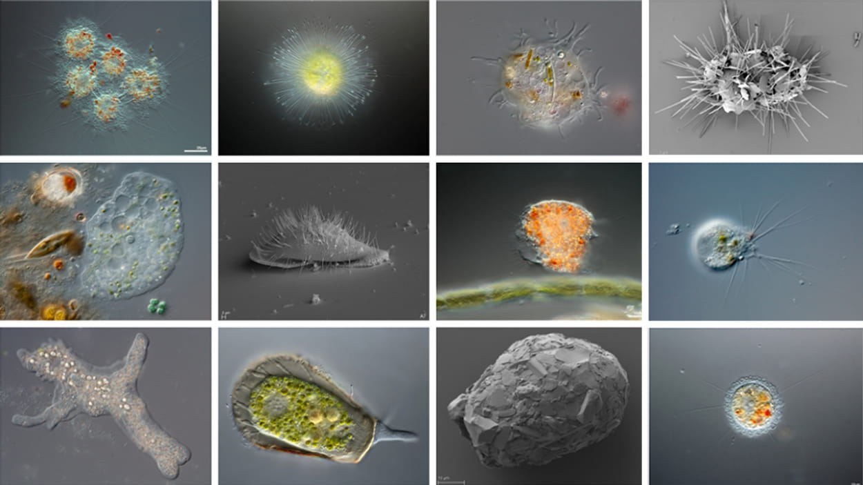 Protisten zitten overal - Vroege Vogels - BNNVARA